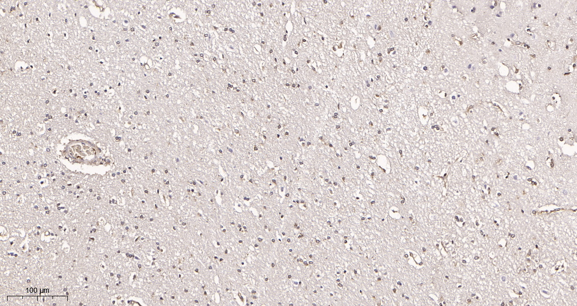Catalase (7N12) Rabbit Monoclonal Antibody