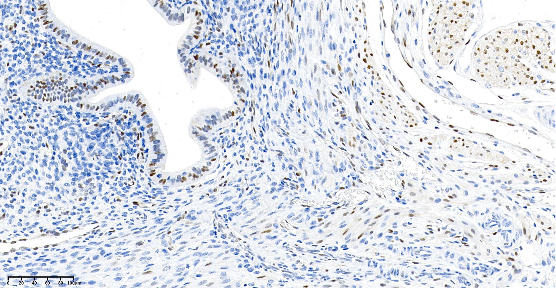 Cyclin D1 (19U18) Rabbit Monoclonal Antibody