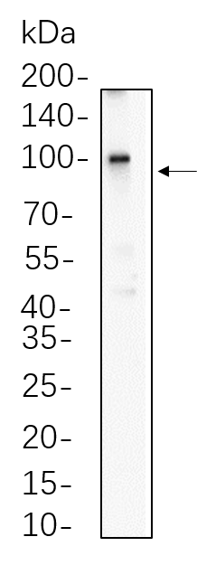 β Catenin (Phospho Thr41/Ser45) (11O4) Rabbit Monoclonal Antibody