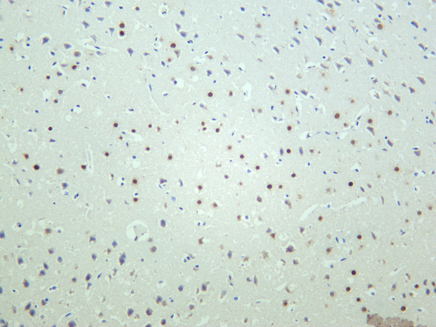 EGR1 (5A9) Rabbit Monoclonal Antibody