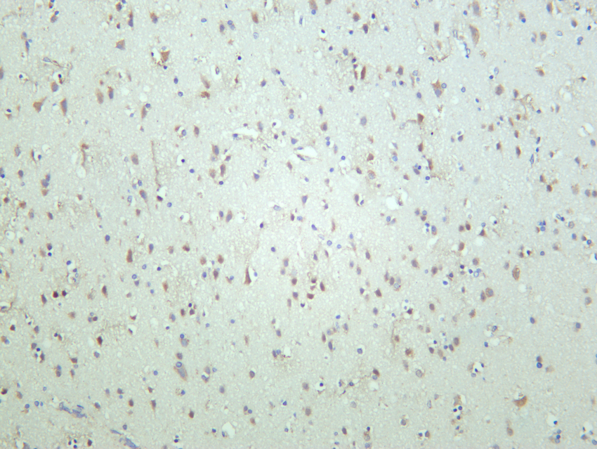 EGR1 (5A9) Rabbit Monoclonal Antibody