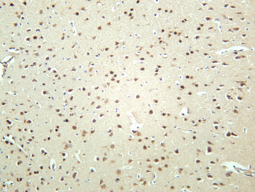EGR1 (5A9) Rabbit Monoclonal Antibody