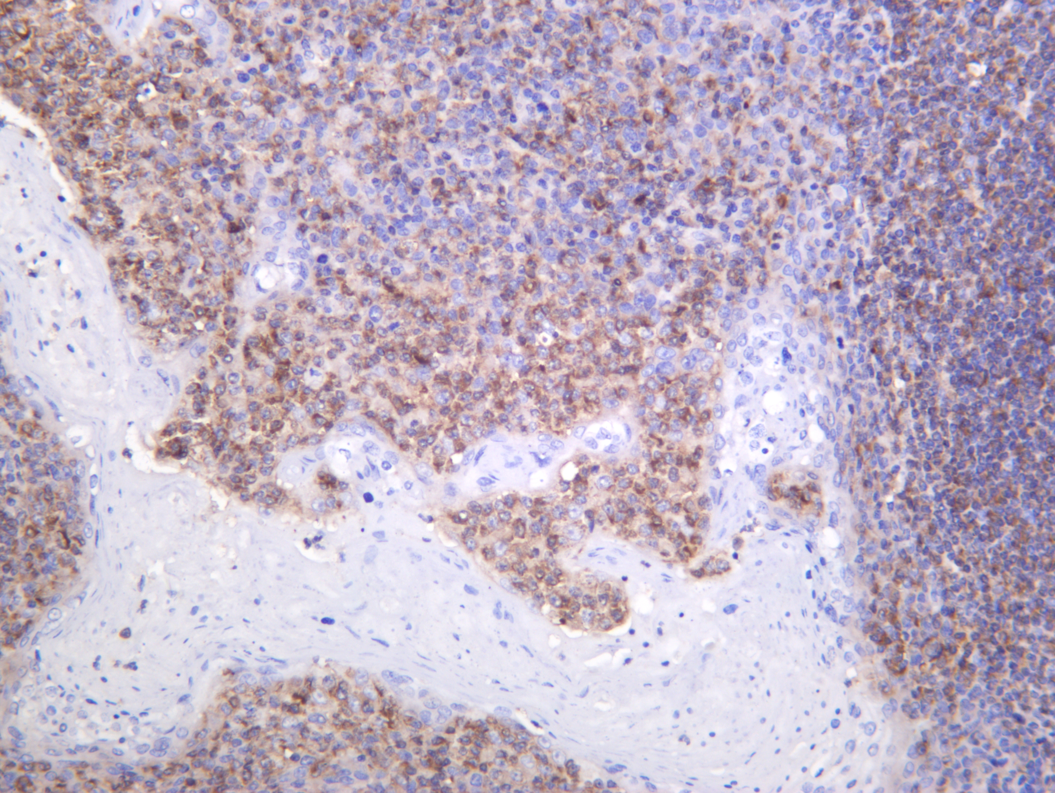 AIM2 (11X18) Rabbit Monoclonal Antibody