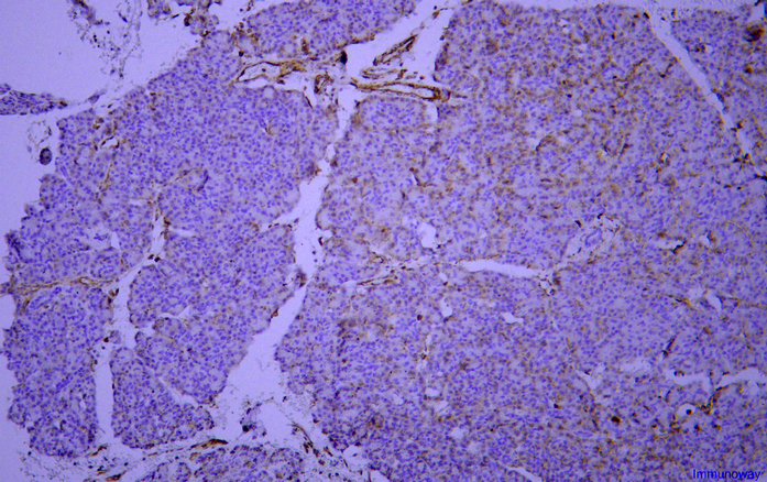 Vimentin (1T4) Mouse Monoclonal Antibody