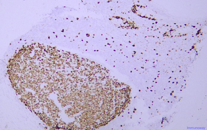 Ki-67 (7C5) Mouse Monoclonal Antibody