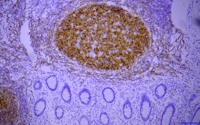 CD20 (2J5) Mouse Monoclonal Antibody
