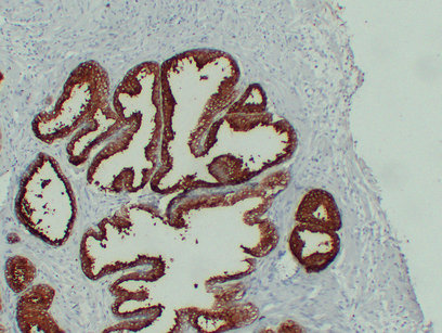 Prostate-Specific Antigen(PSA) (6B1) Mouse Monoclonal Antibody