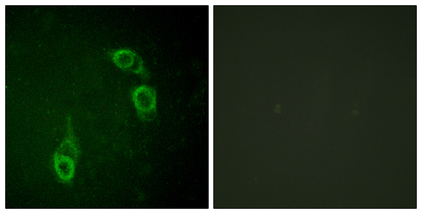 APC1 Polyclonal Antibody