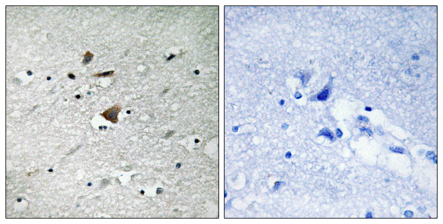 APC1 Polyclonal Antibody